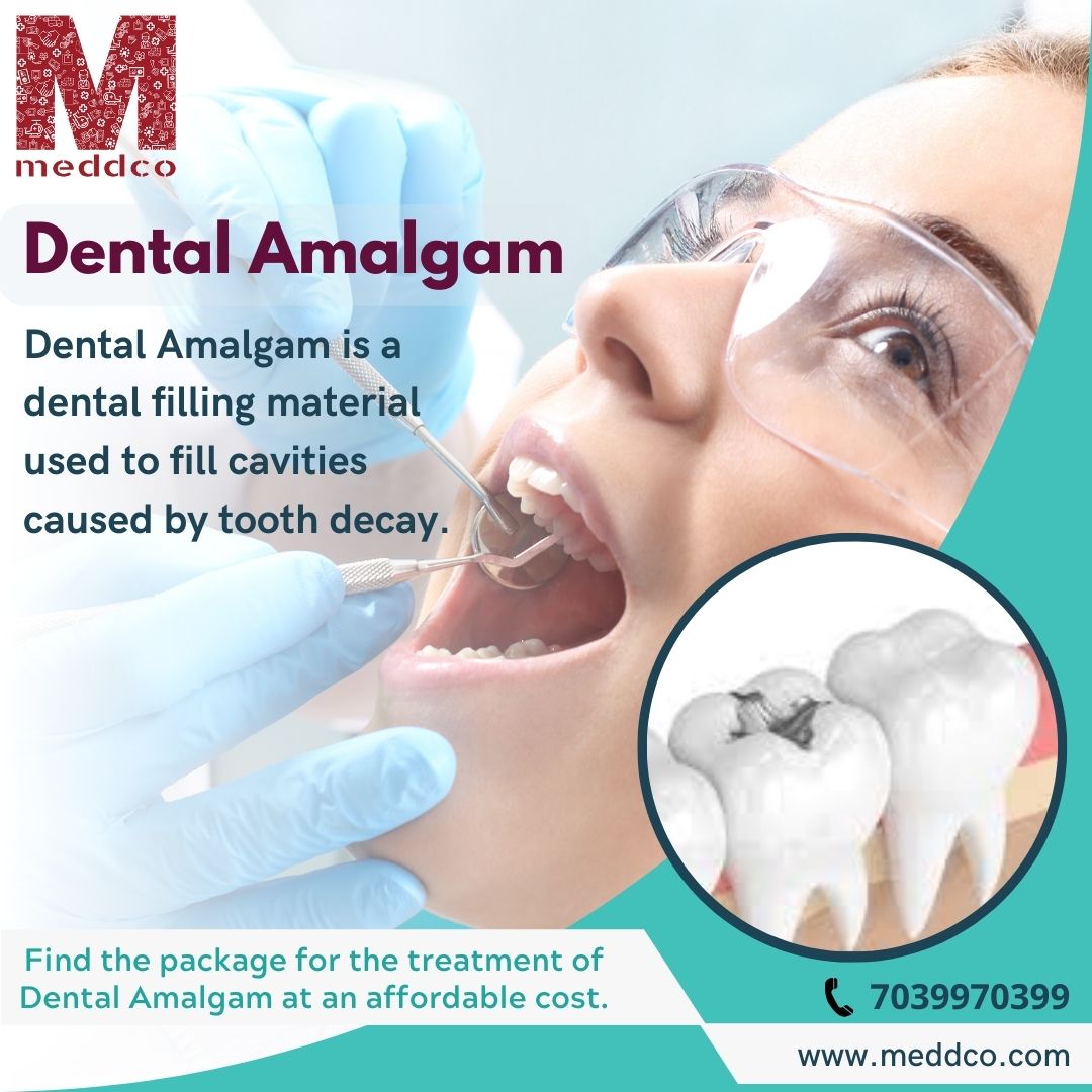 Are Amalgam Restoration Safe 