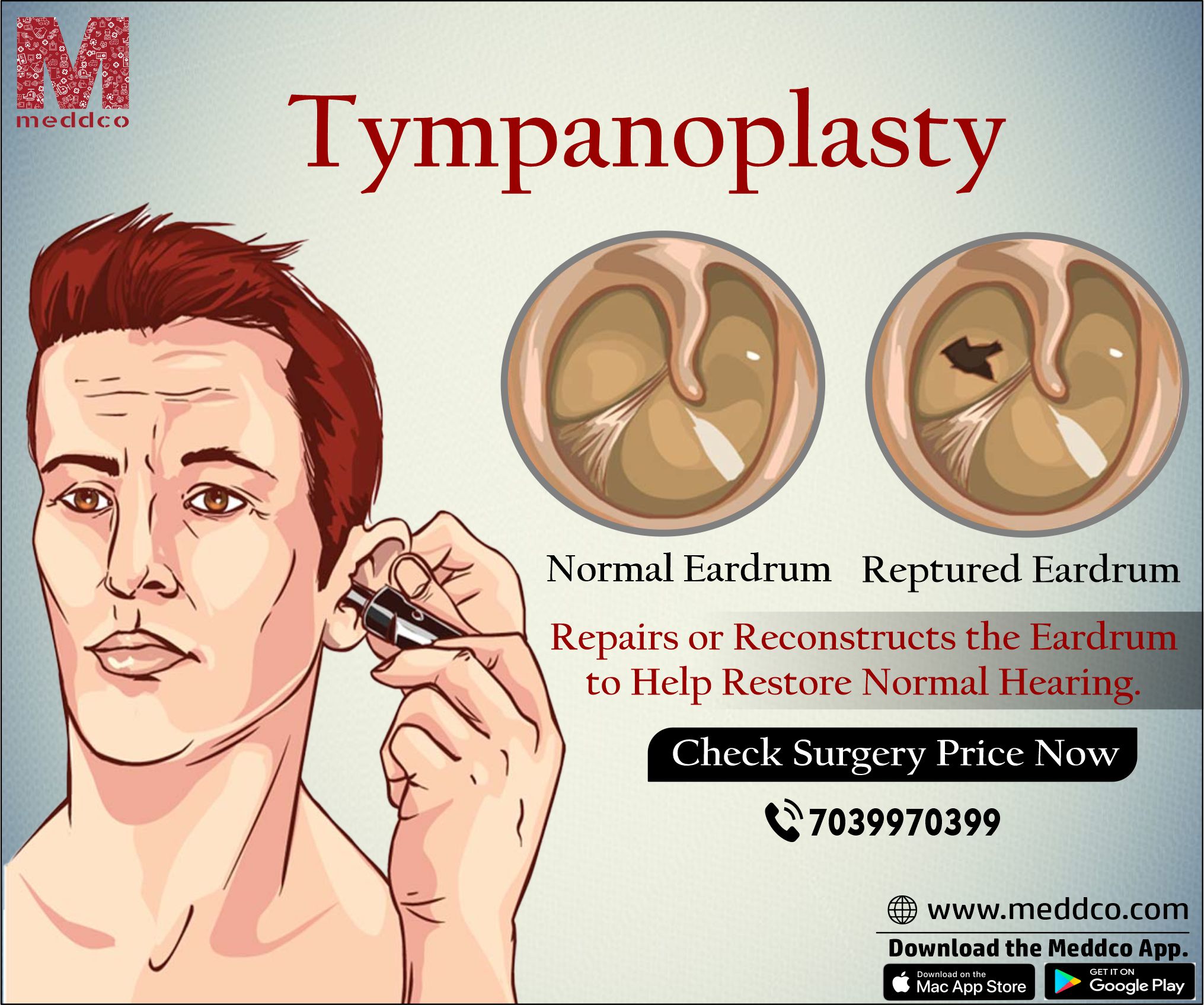 Tympanoplasty Tympanoplasty