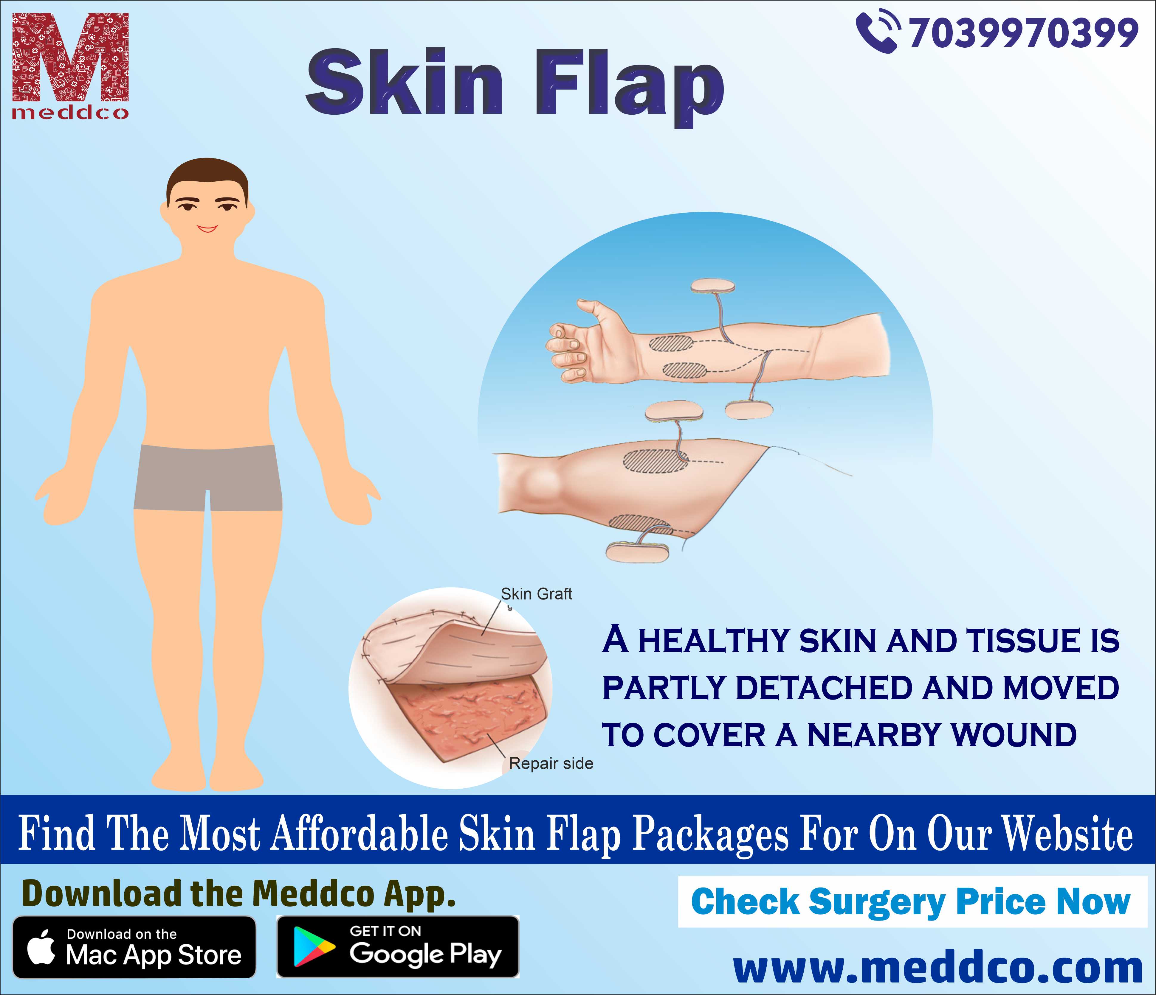 What Are Different Types Of Flap Surgeries What Are Different Types Of Flap Surgeries